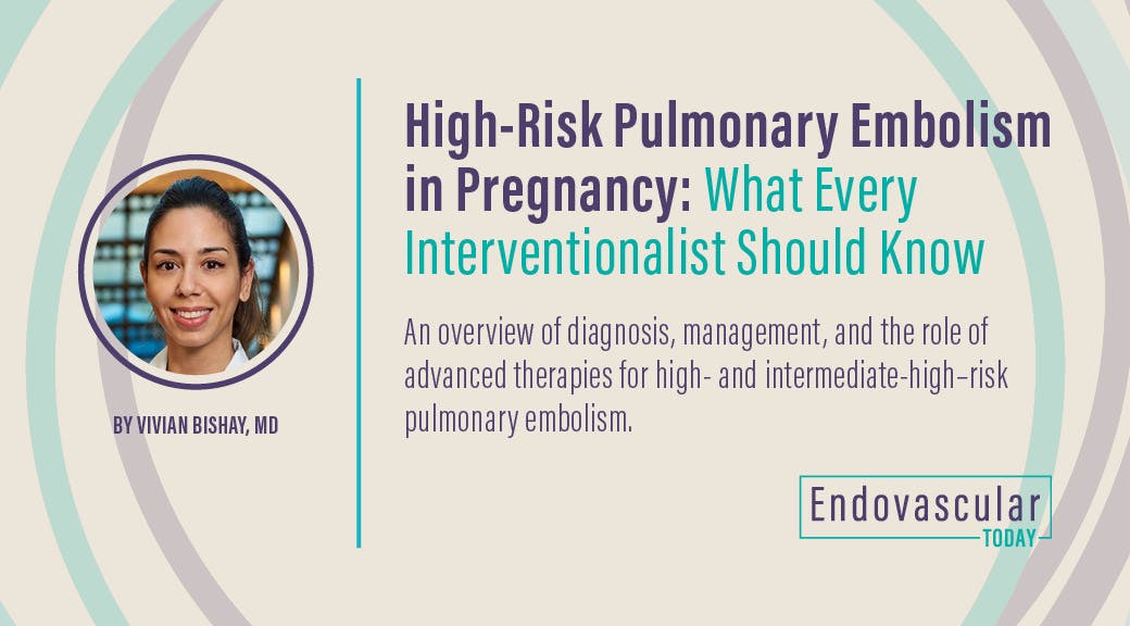 High-Risk Pulmonary Embolism in Pregnancy: What Every Interventionalist ...
